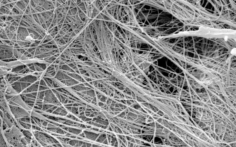 New and promising opportunities for treating skin fibrosis - Softmat